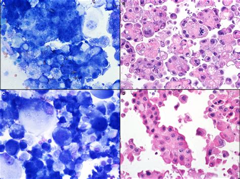 Mesothelial Cells In Synovial Fluid