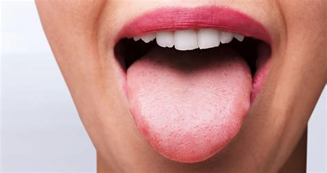 Do You Have A Healthy Tongue 4 Popular Tongue Diseases