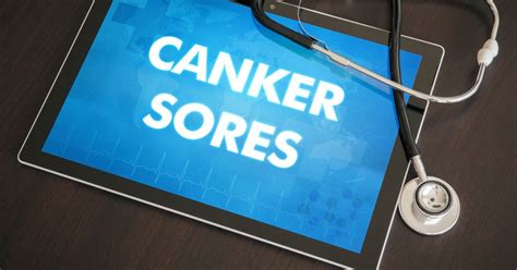 Causes Of Canker Sores Facty Health