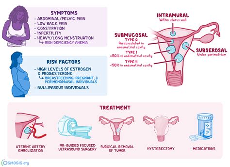 Leiomyoma Of Uterus Uterine Fibroid What Is It Causes Types Osmosis