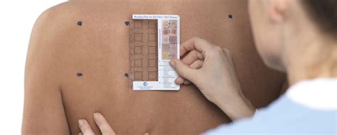 Patch Testing Ferrer Pharma