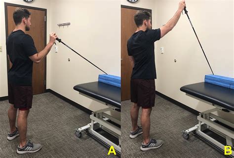 Subscapularis Strengthening Exercises