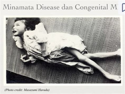 Ikan Dengan Merkuri Tinggi Minamata Disease Forsains