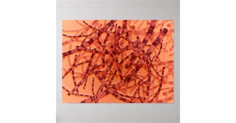 Microscopic View Of Anthrax 3 Poster Zazzle