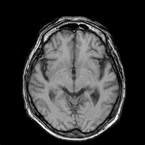 Brain Mri Dataset Dicom Images Unidatapro