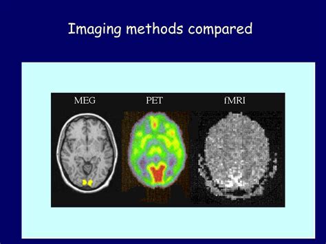 ppt functional brain imaging cont d meg powerpoint presentation