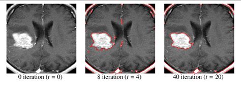 Figure 2 From A Fast And E ﬃ Cient Numerical Algorithm For Image Segmentation And Denoising