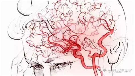 年轻人血管性痴呆离你并不远 知乎