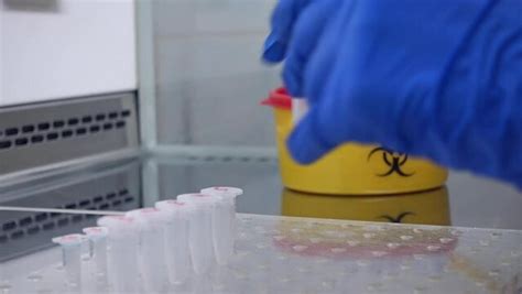 Eppendorf Images Parcourir 1654 Le Catalogue De Photos Vecteurs Et Vidéos Adobe Stock