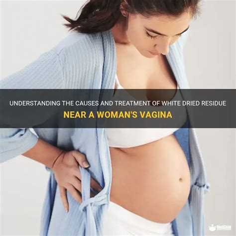 Understanding The Causes And Treatment Of White Dried Residue Near A Woman S Vagina MedShun