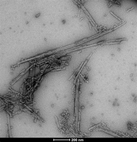 Human Tau Dgae 297 391 Ad Mimic Pffs Spr 502