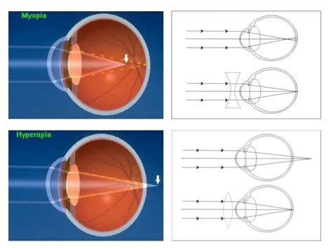Class 8 Teaching Ppt For Chapter Light Pptx