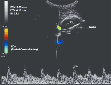 Transtemporal Window Oblique Dorsal Plane Note The Normal Typical Download Scientific Diagram