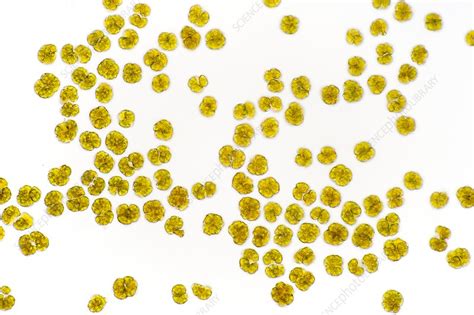 Botryococcus Green Algae Micrograph Stock Image C029 3495 Science Photo Library