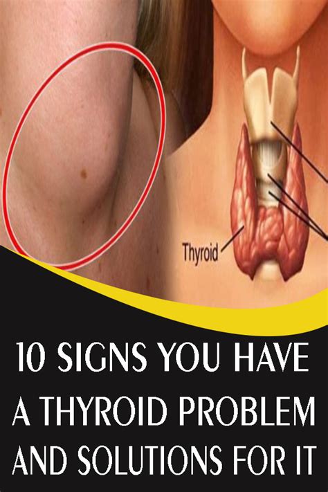 10 Signs You Have A Thyroid Problem And Solutions For It Abilenebeuty