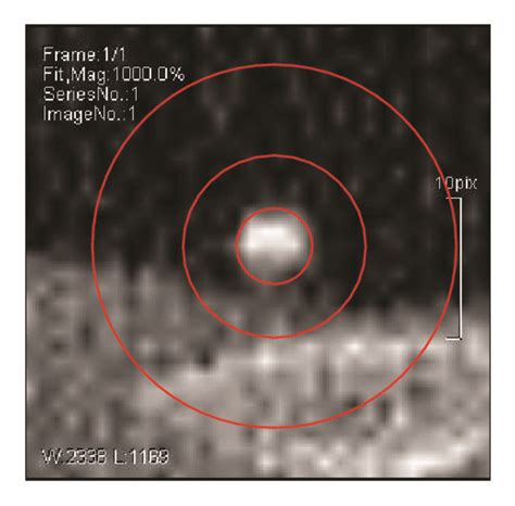 Demonstration Of Local Difference Pattern Ad Are Four Types Of Download Scientific