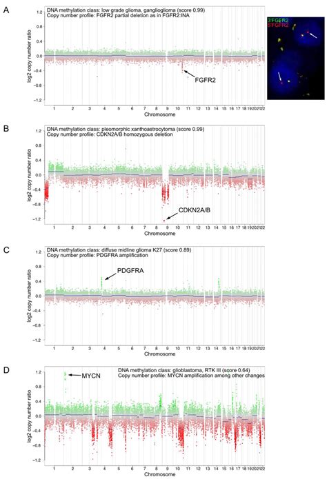 Examples Of Cnv Plots From Dna Methylation Array Showing Relevant Download Scientific Diagram