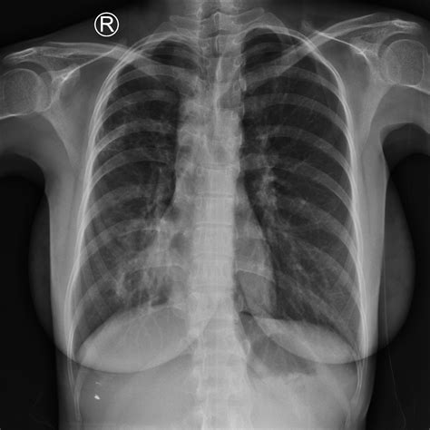 Classify Project 2 Classification Dataset By Project