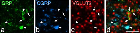 High Magnification View Of Grp Cgrp And Vglut2 In The Superficial