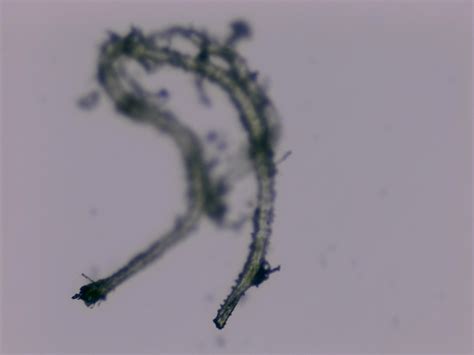 Microscopic Parasitic Lyme Nematomorphs Carry Junk Around With Them