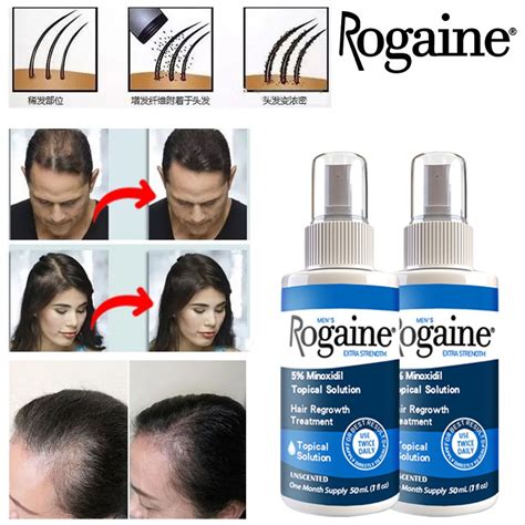 Rogaine Mens Extra Strength 5 Minoxidil Topical Solution For Hair
