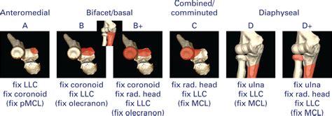 Elbow Dislocation Classification