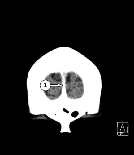 Coronal CT Head Anatomy W O Contrast Flashcards Quizlet