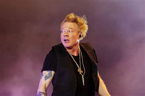 Axel Rose Axl Roses Cosmetic Surgery The Transformation Of A Rock
