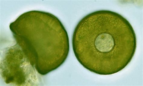 Protist Images Arcella