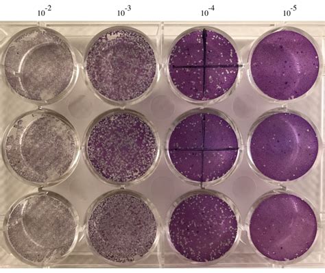 Plaquing Of Herpes Simplex Viruses Scientific Article Protocol Jove