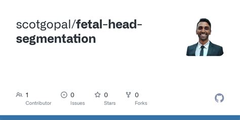 fetal head segmentation dataloaders py at main · scotgopal fetal head