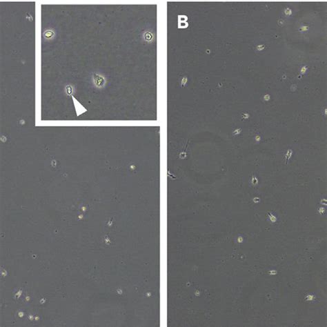 Microglia Must Reach Rod Like And Ramified Morphologies Before