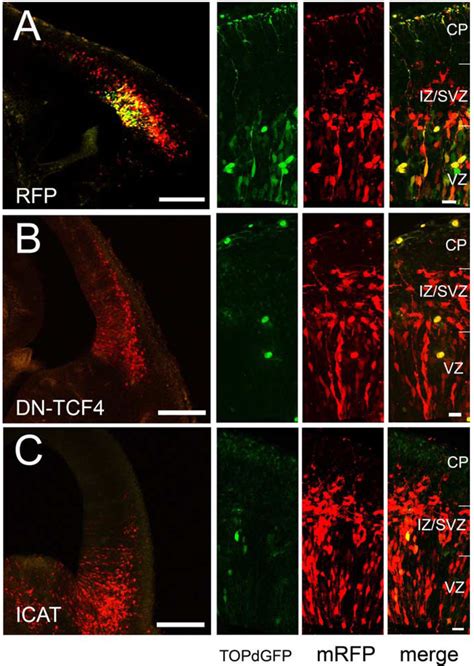 β Catenin Signaling In Cortical Neural Precursors β Catenin Signaling