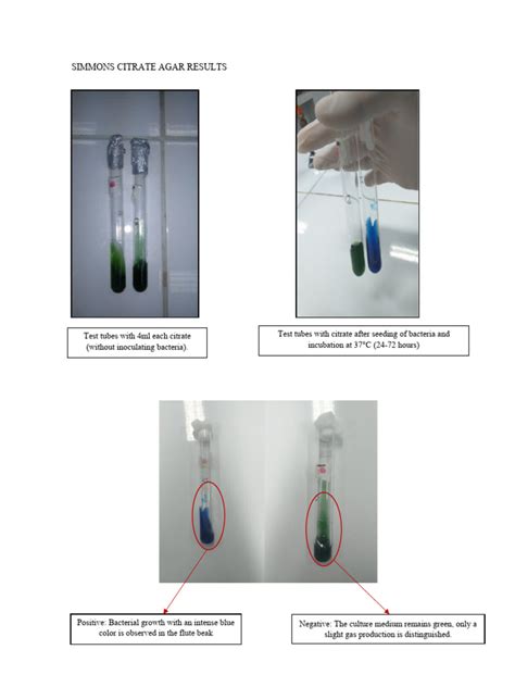 Simmons Citrate Agar Results Pdf Growth Medium Bacteria