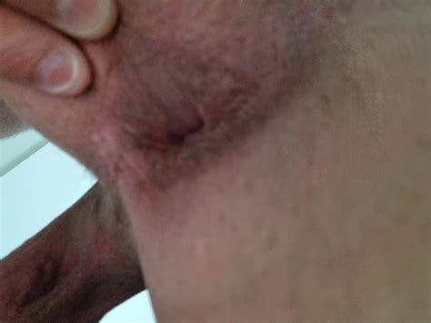 Fetiche Pics Xhamster