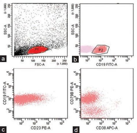 Cryoglobulinemia As An Initial Manifestation Of Underlying