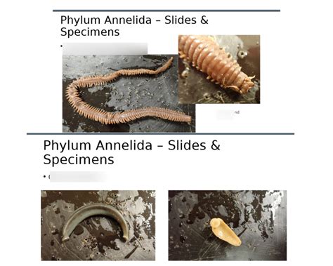 Phylum Annelida Diagram Quizlet