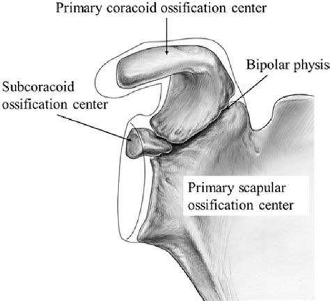 Development Of The Coracoid Process At Age 12 To 13 Years Of Age The Download Scientific