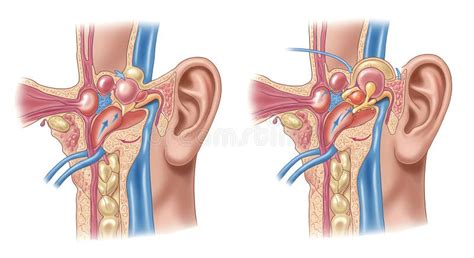 Detailed Medical Illustration Of Human Head And Neck Anatomy Showing The Carotid Body And Sinus