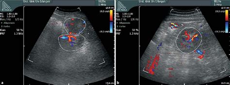 Figure 2 From Dynamic Tissue Perfusion Measurement A New Tool For