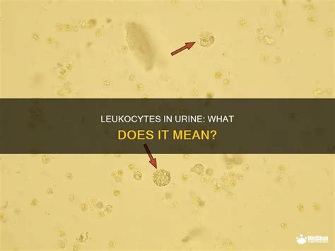 Leukocytes In Urine What Does It Mean Medshun