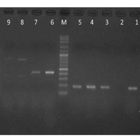 Pcr Analysis Of B Cereus Isolates And Toxin Genes M 100 Bp Dna Download Scientific Diagram