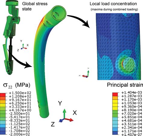 Finite Element Analysis Of The Axial Stress σ 22 Distribution In The Download Scientific