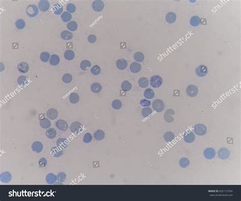 Reticulocyte Stain
