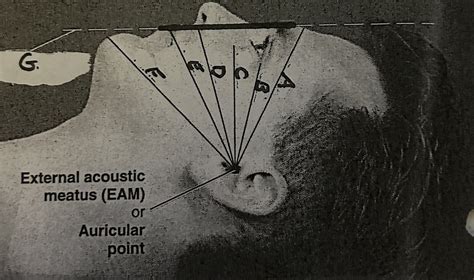 Positioning Lines Diagram Diagram Quizlet