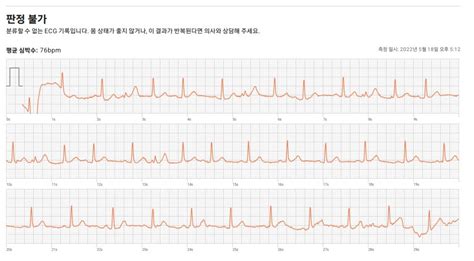 갤럭시 워치 4 심전도 결과를 봐주시길 부탁드려요 궁금할 땐 아하