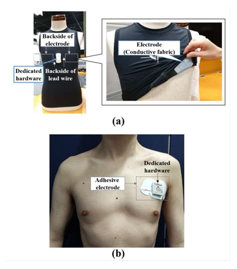 Examples Of Commercial Single Channel Wearable ECG Devices That Have Download Scientific