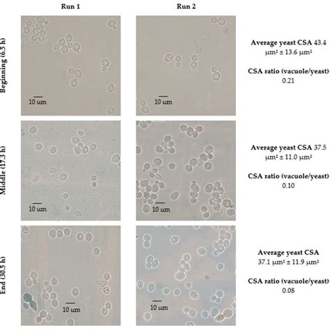 A Microscopic Image Of Yeast Cells 1000× Magnification At 65 H