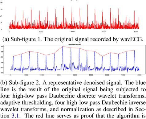 Figure 1 From Ecgnet A Generative Adversarial Network Gan Approach To The Synthesis Of 12