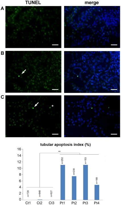 Apoptosis Was Determined By The Presence Of Dna Fragmentation Detected Download Scientific